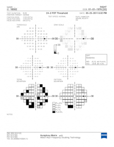 Humphrey Matrix – RedTitan
